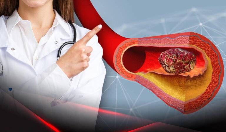 Tromboza venoasa profunda: Iata care sunt simptomele la care ar trebui ...